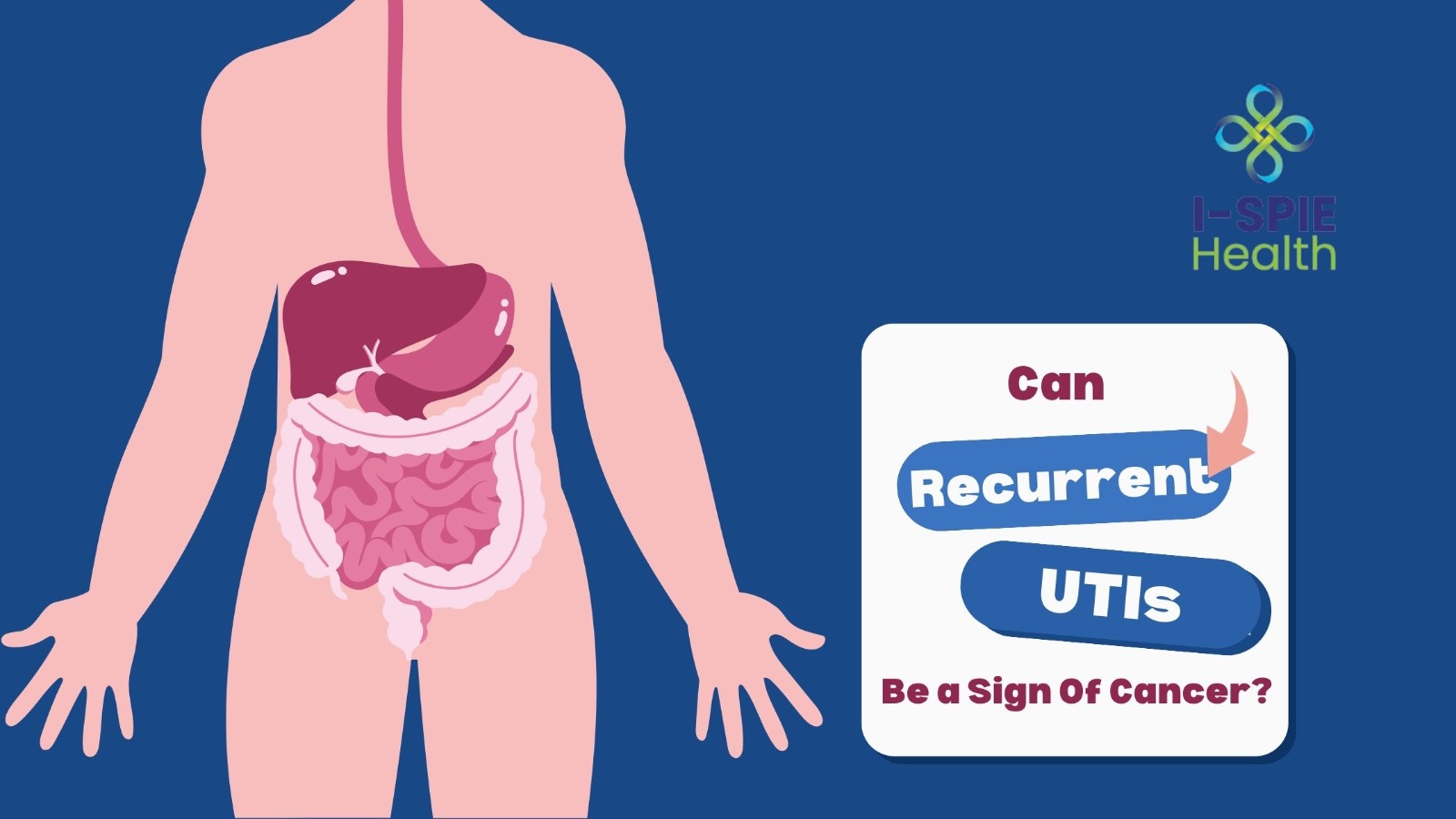 Can Recurrent UTIs be a sign of cancer? What You Need to Know!
